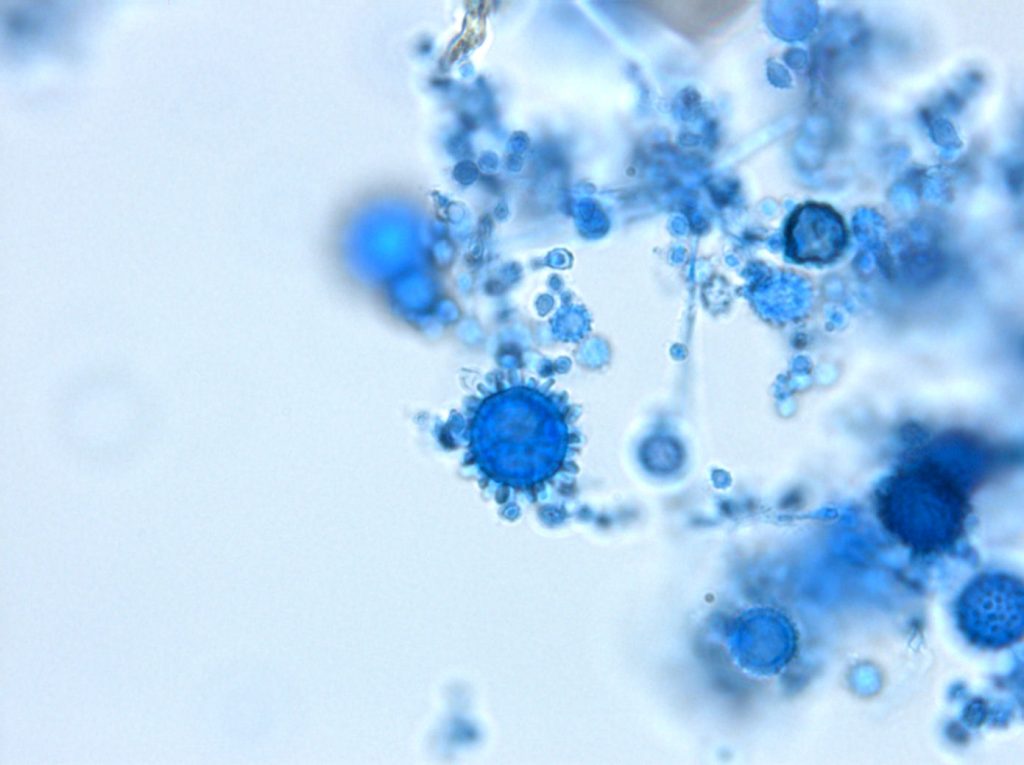 Hongos dimórficos - Life Worldwide ES