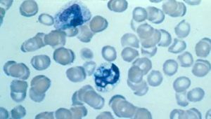 Hongos dimórficos - Life Worldwide ES