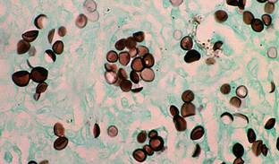 Hongos dimórficos - Life Worldwide ES