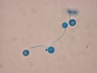 Hongos dimórficos - Life Worldwide ES