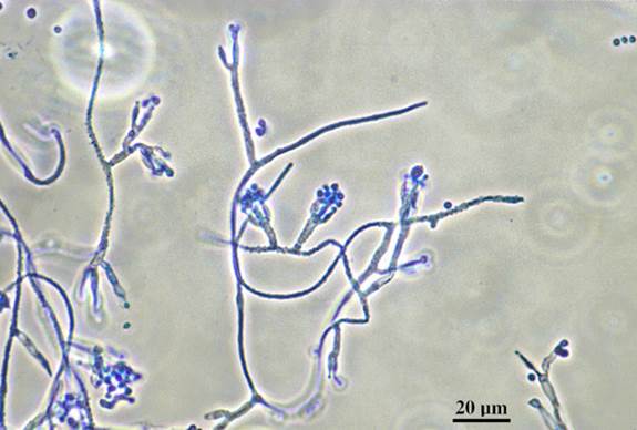 Hongos dimórficos - Life Worldwide ES