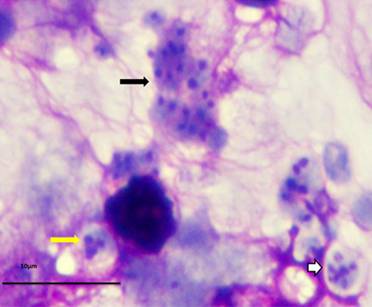 Hongos dimórficos - Life Worldwide ES