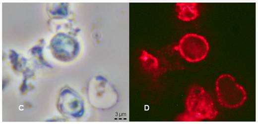 Hongos dimórficos - Life Worldwide ES