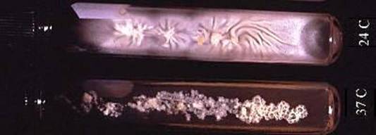 Hongos dimórficos - Life Worldwide ES