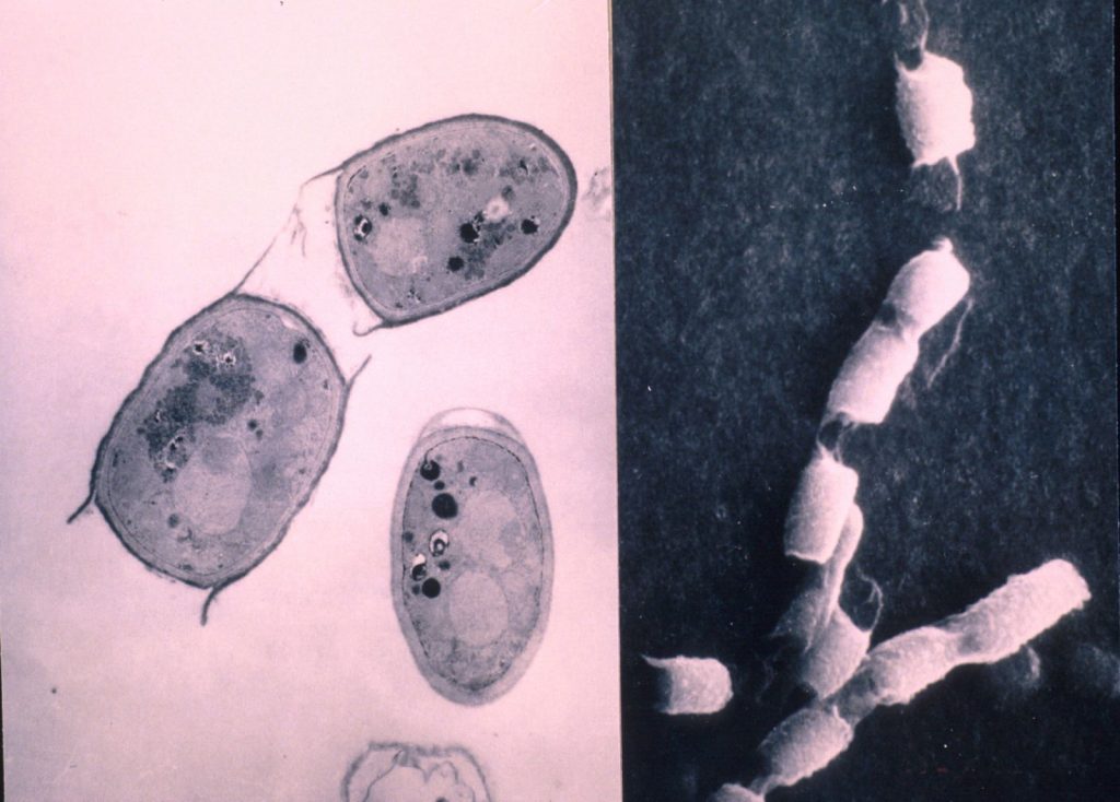 Hongos dimórficos - Life Worldwide ES