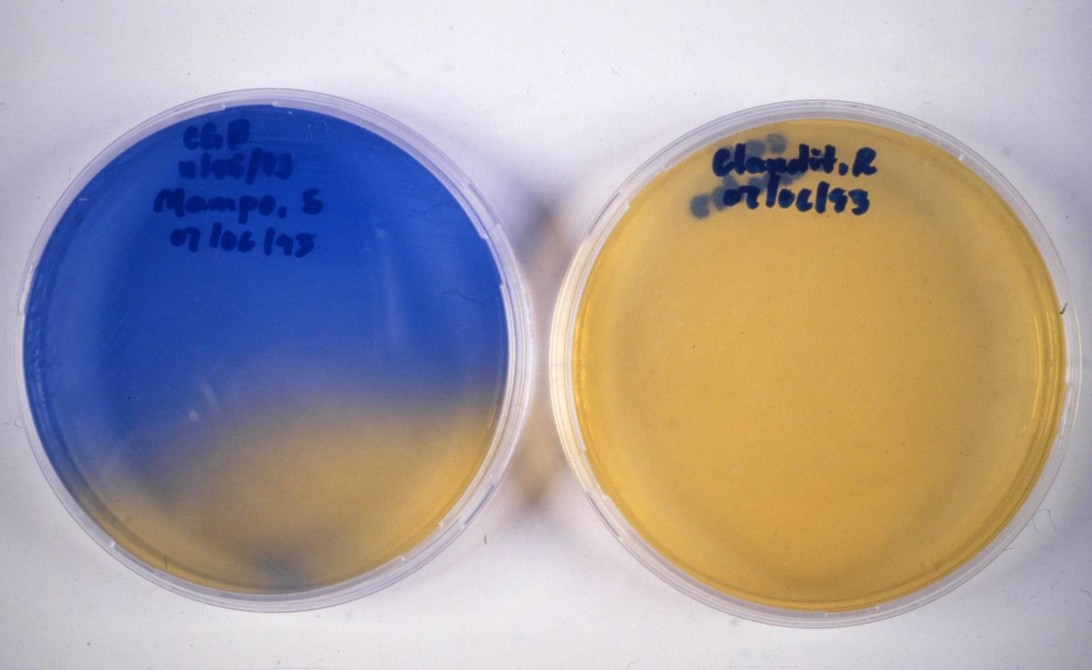 Cryptococcus spp. - Life Worldwide ES
