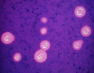 Cryptococcus spp. - Life Worldwide ES