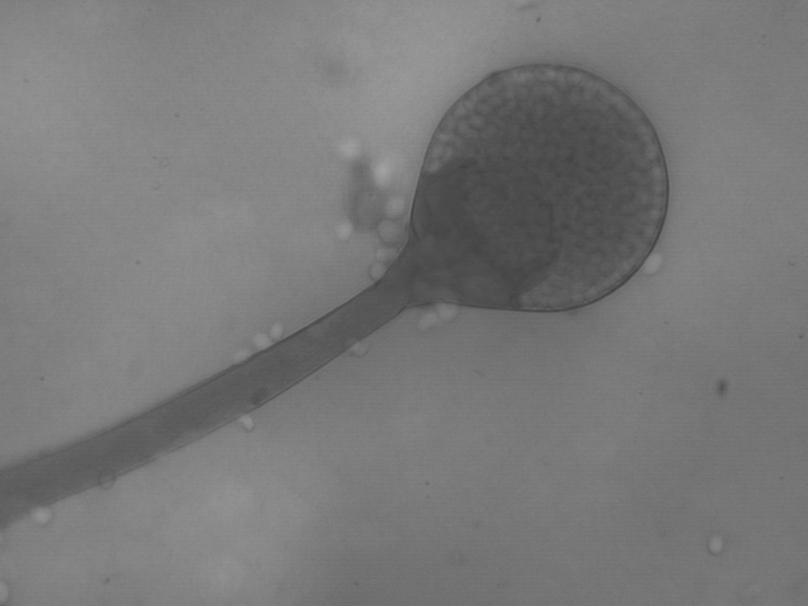 Lichtheimia spp. - Life Worldwide ES