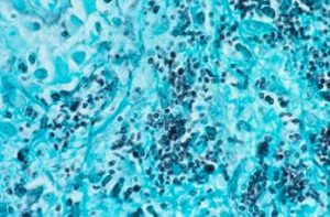 Hongos dimórficos - Life Worldwide ES