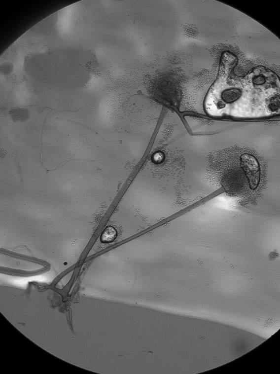 Rhizopus spp. - Life Worldwide ES