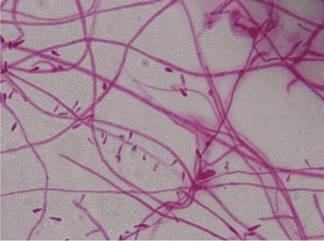 Trichophyton spp. - Life Worldwide ES